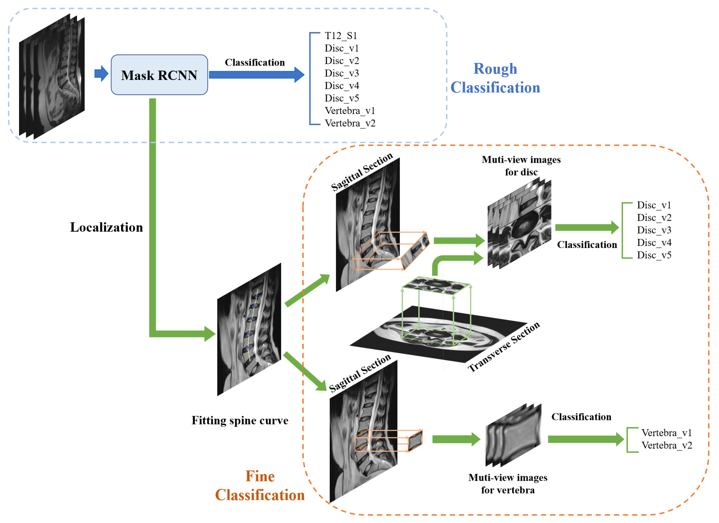Deep Learning-Based Intelligent Diagnosis of Lumbar Diseases with Multi ...