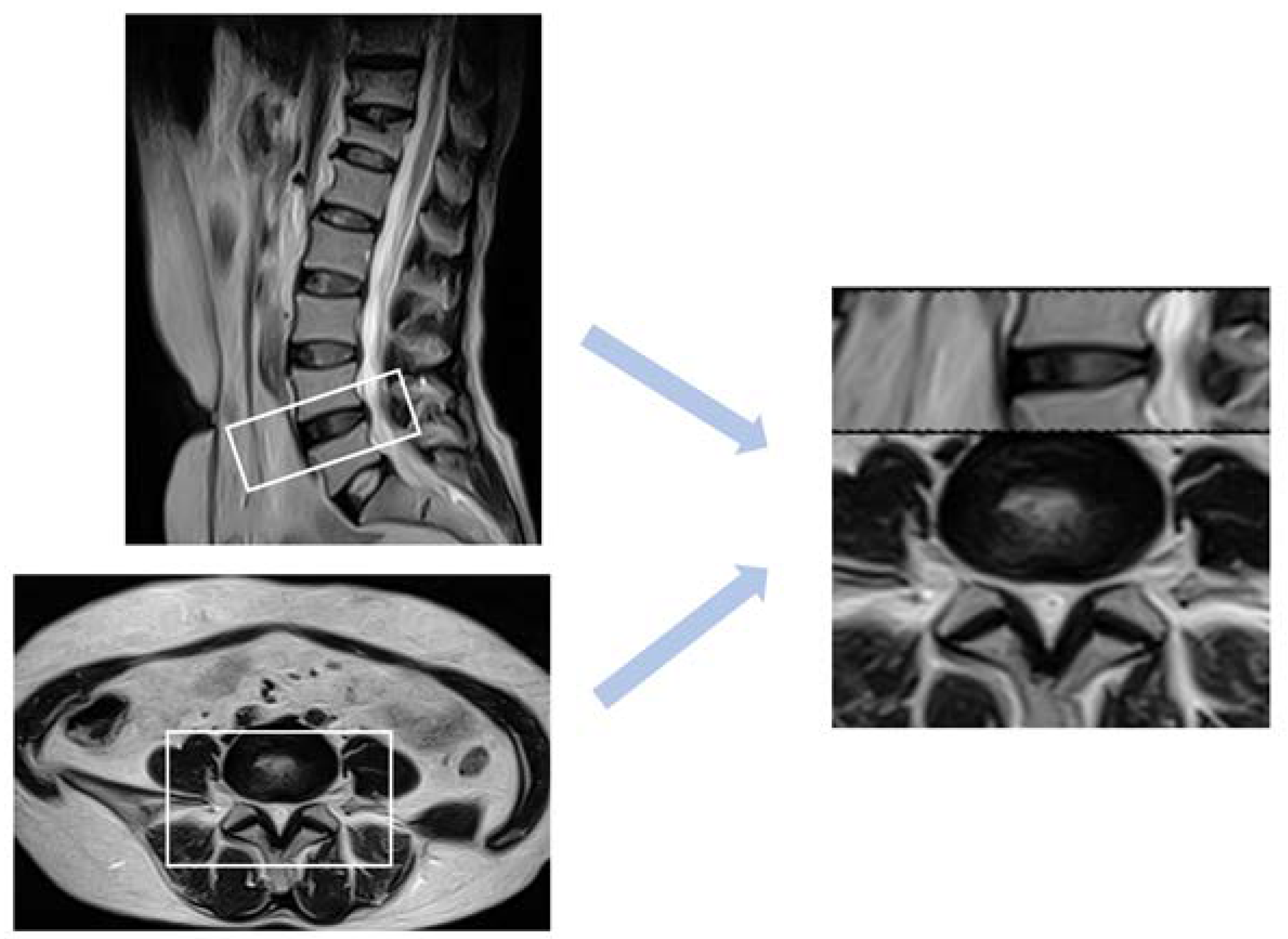 Deep Learning-Based Intelligent Diagnosis of Lumbar Diseases with Multi ...
