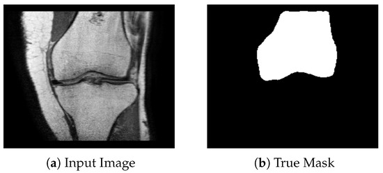 Enhanced Attention Res-Unet for Segmentation of Knee Bones