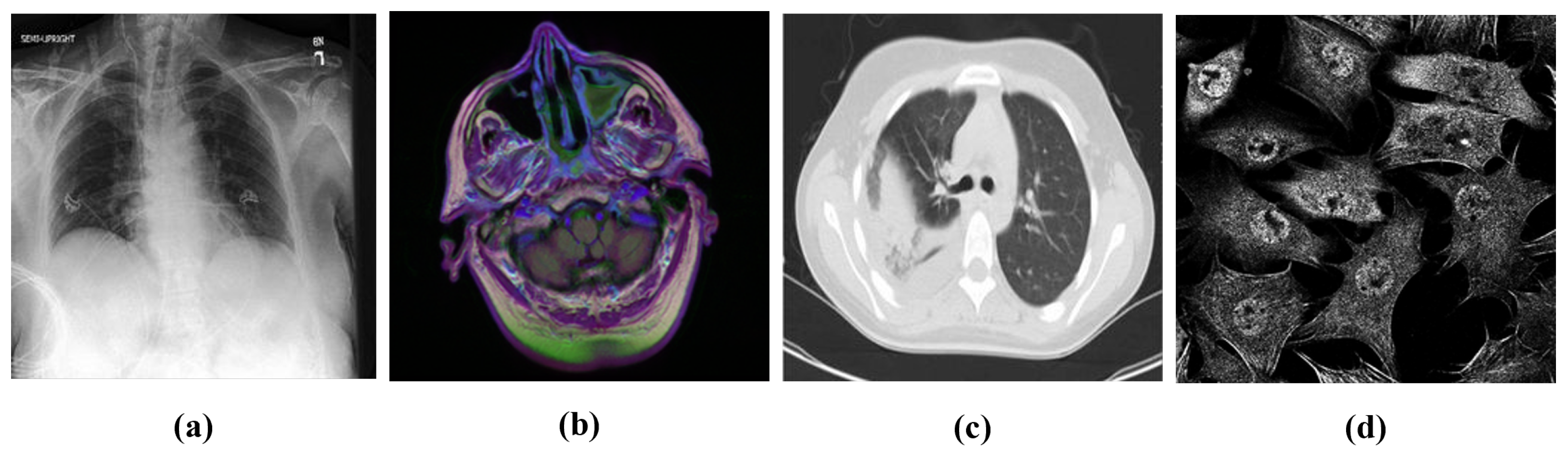 Mathematics | Free Full-Text | Transformative Noise Reduction ...