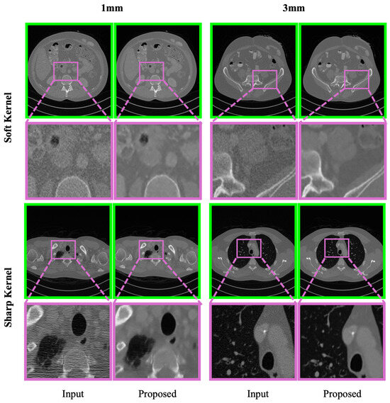Mathematics | Free Full-Text | Transformative Noise Reduction ...