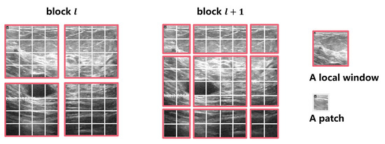 An Interpretable Breast Ultrasound Image Classification Algorithm Based on Convolutional Neural ...