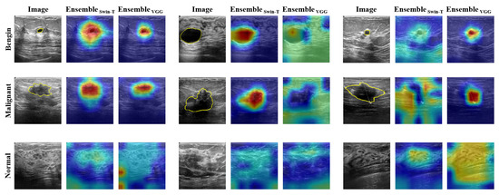 An Interpretable Breast Ultrasound Image Classification Algorithm Based ...