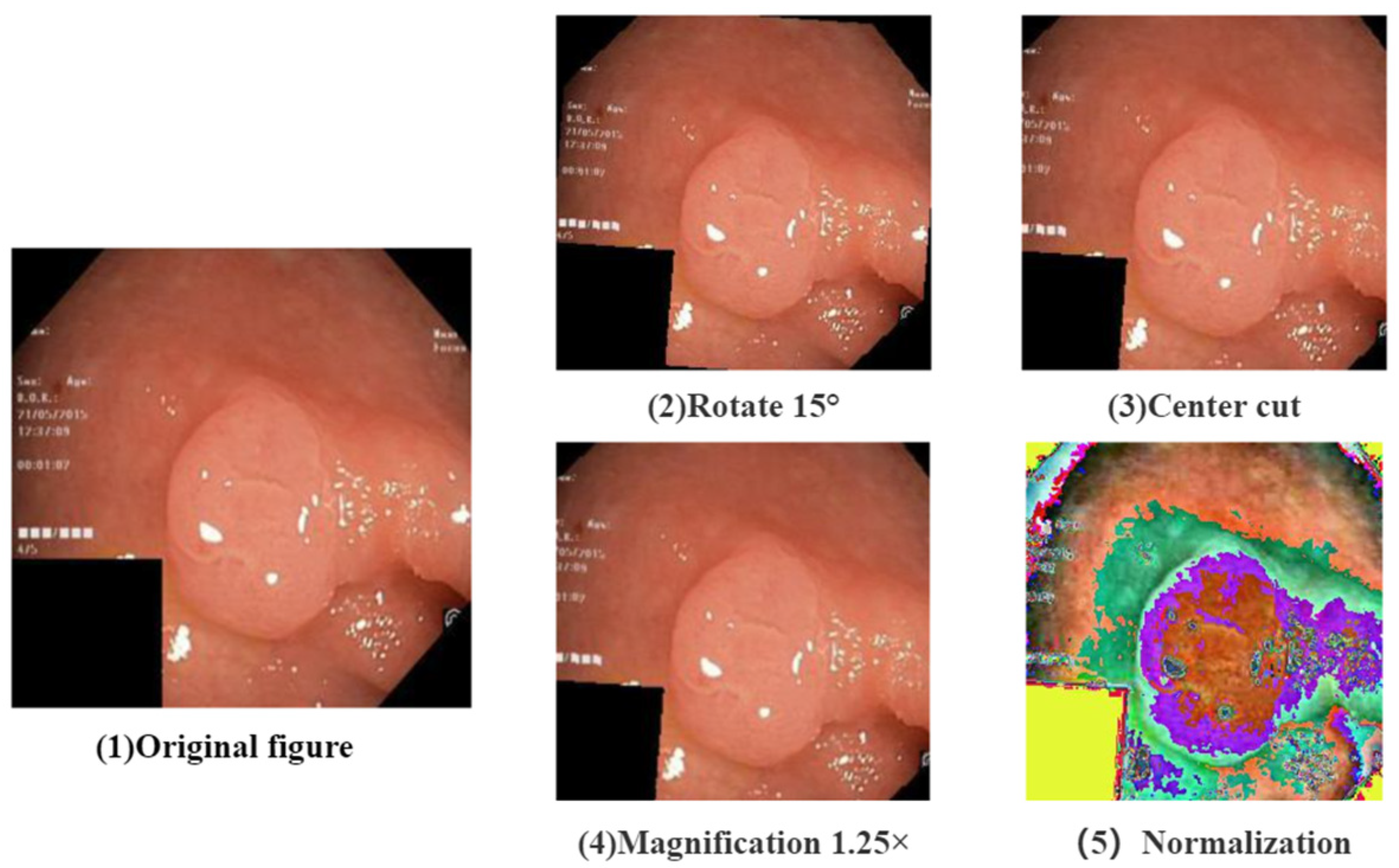 Mathematics | Free Full-Text | An Improved Medical Image Classification Algorithm Based on Adam ...