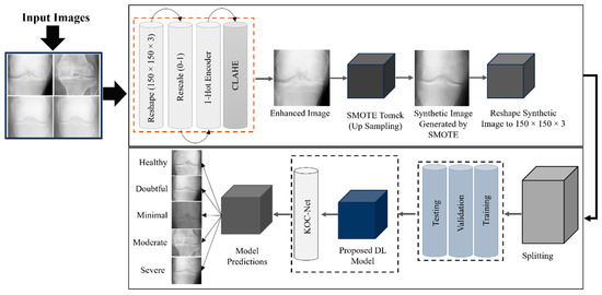 KOC_Net: Impact of the Synthetic Minority Over-Sampling Technique with ...