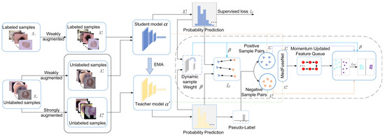 Enhanced Semi-Supervised Medical Image Classification Based on Dynamic Sample Reweighting and ...