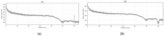 Emotion Recognition from EEG Signals Using Advanced Transformations and ...