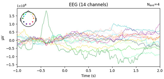 Emotion Recognition from EEG Signals Using Advanced Transformations and ...