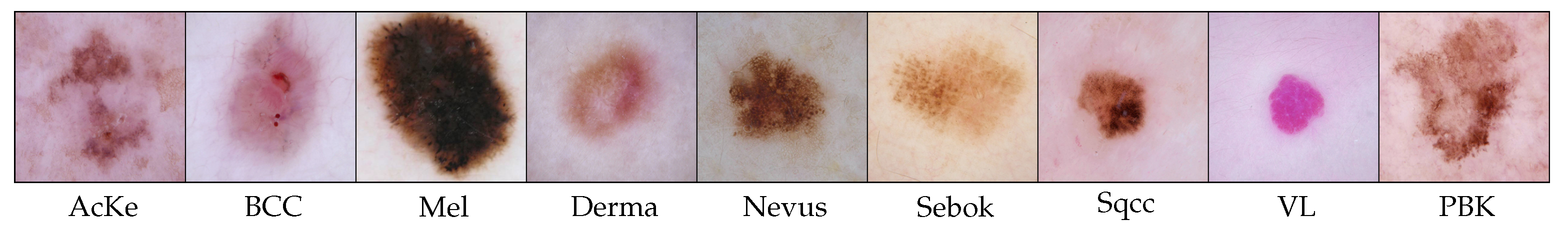 Enhancing Recognition and Categorization of Skin Lesions with Tailored Deep Convolutional ...