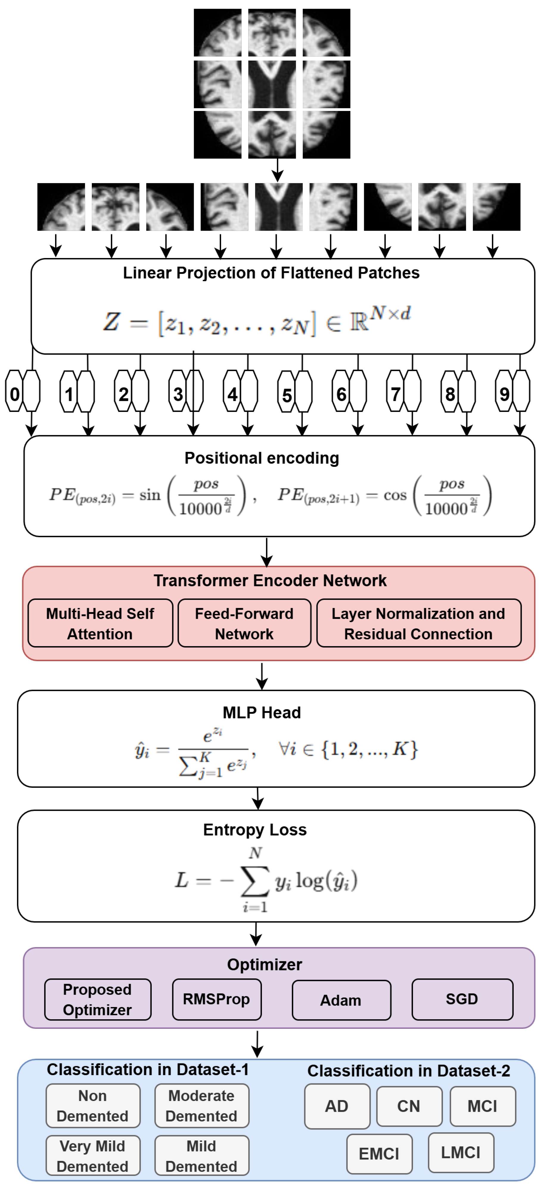 Alzheimer’s Disease Detection in Various Brain Anatomies Based on ...