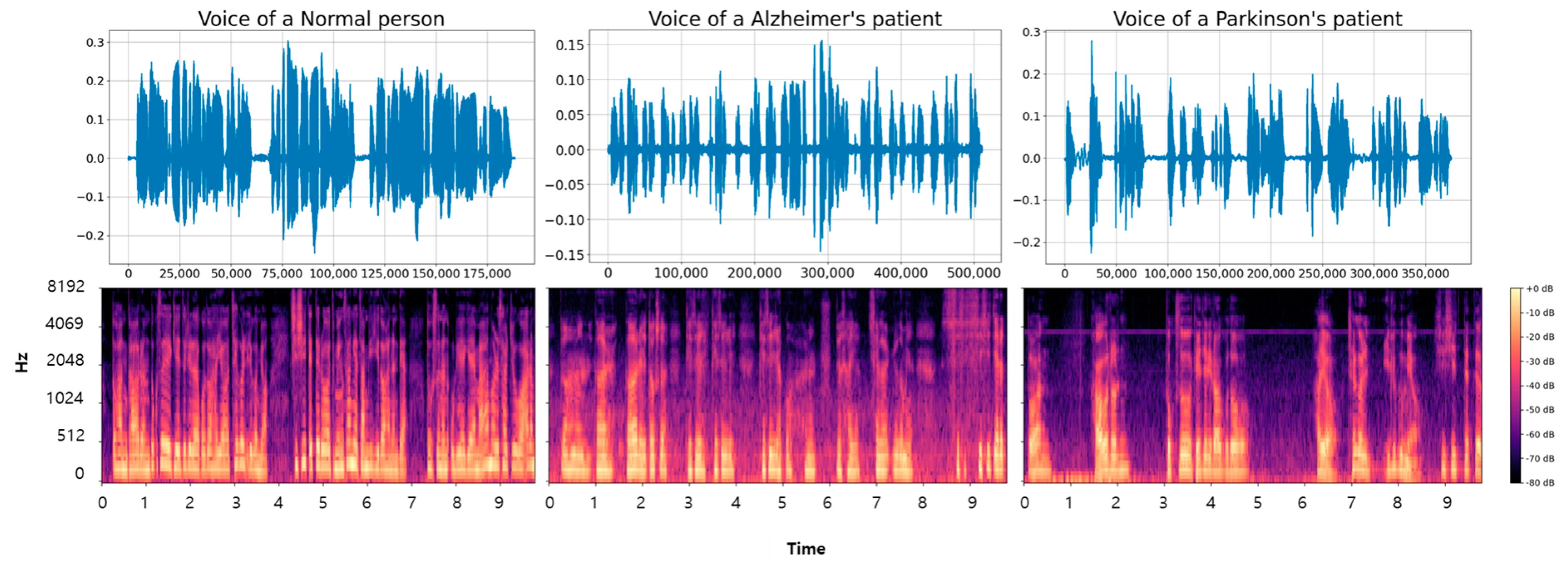 Enhancing the Accuracy of Image Classification for Degenerative Brain ...