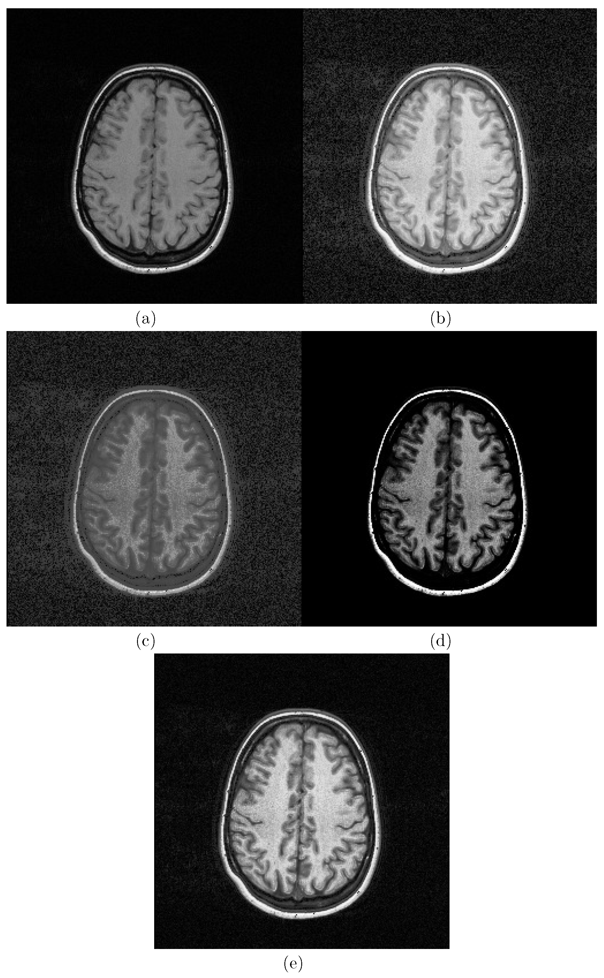 Local Contrast Enhancement in Digital Images Using a Tunable Modified ...