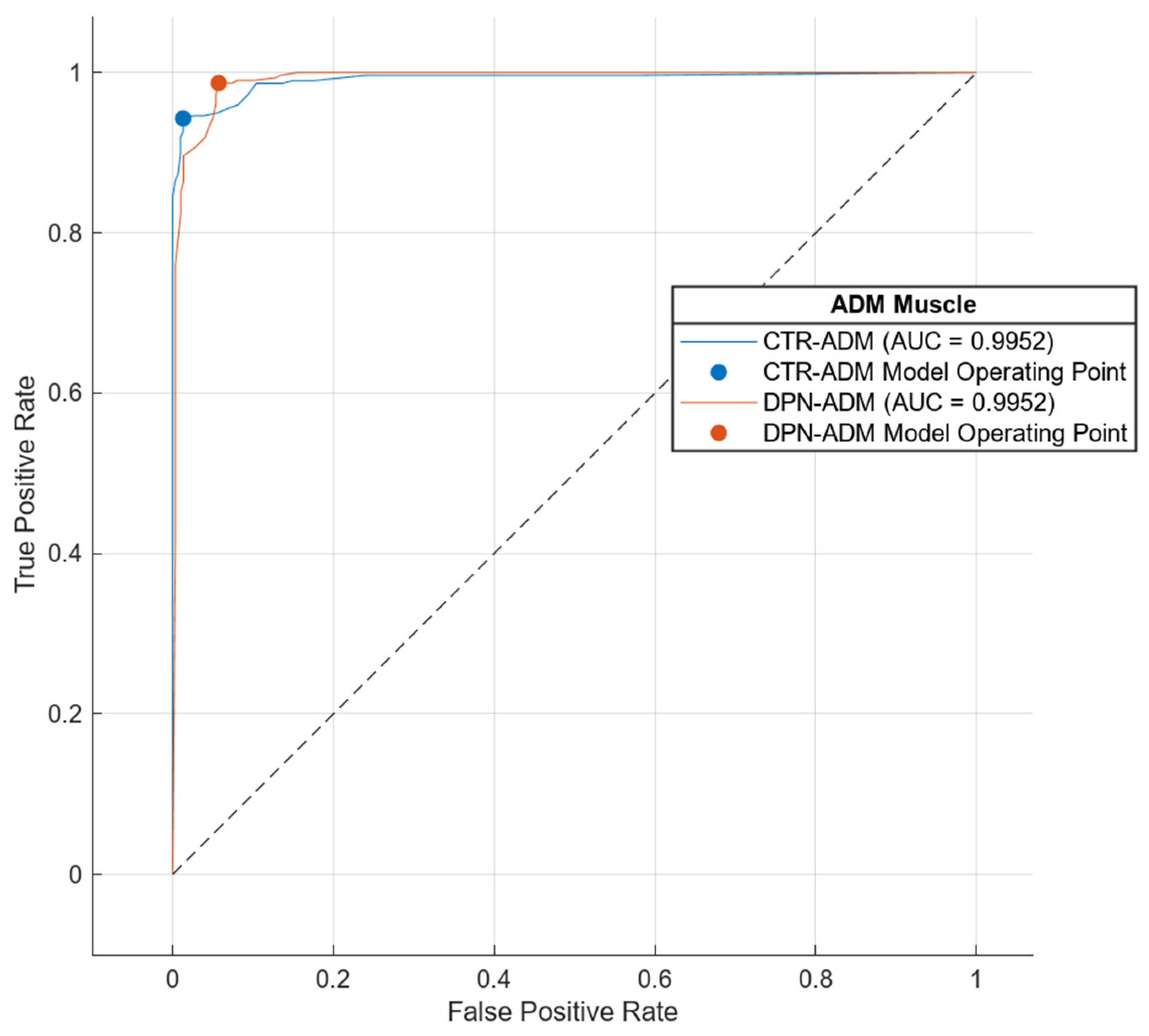Bag of Feature-Based Ensemble Subspace KNN Classifier in Muscle Ultrasound Diagnosis of Diabetic ...