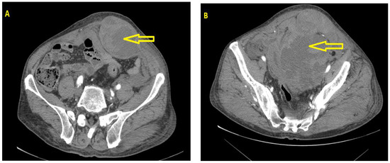 Medicina | Free Full-Text | Comparison of the Different Treatment ...