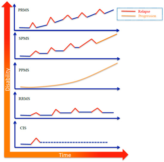 Cerebrospinal Fluid Analysis in Multiple Sclerosis Diagnosis: An Update