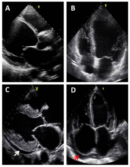 Handheld Ultrasound and Focused Cardiovascular Echography: Use and ...