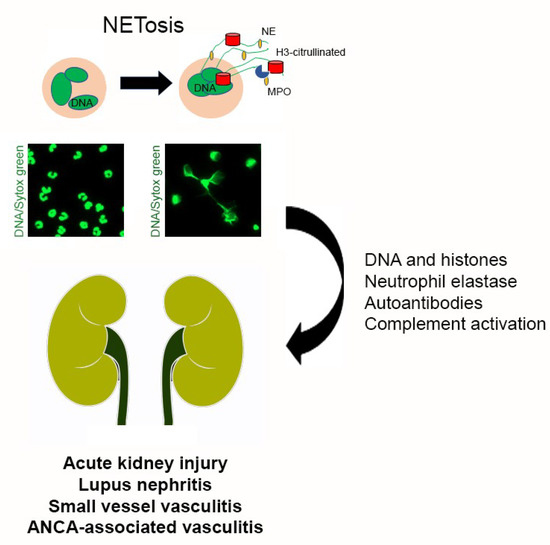 Neutrophil Extracellular Traps in the Establishment and Progression of ...