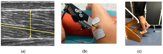 Pain and Function in the Runner a Ten (din) uous Link