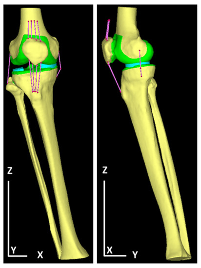 Medicina | Free Full-Text | Development of a Knee Joint CT-FEM Model in ...