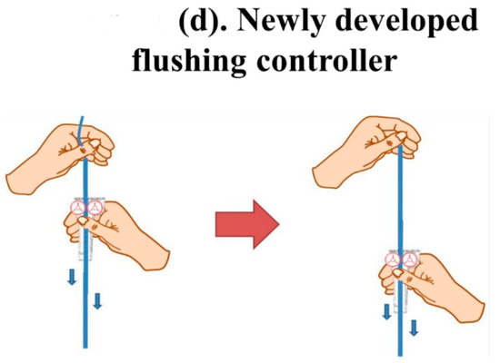 The Efficacy, Safety, and Convenience of a New Device for Flushing ...