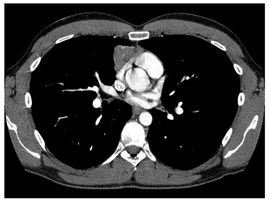 Medicina Free Full Text Correlation Of Computed Tomography