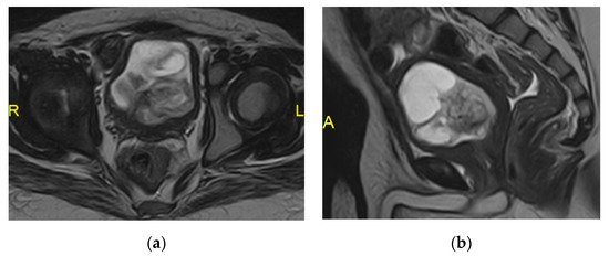 Medicina | Free Full-Text | CT and MRI in Urinary Tract Infections: A ...