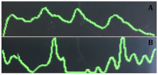Pulp Vitality Testing with a Developed Universal Pulse Oximeter Probe ...