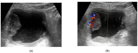 Imaging of Bladder Cancer: Standard Applications and Future Trends