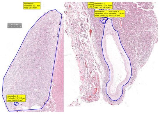 Pineal Gland Histology Acervuli