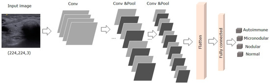 Intelligent Diagnosis of Thyroid Ultrasound Imaging Using an Ensemble ...