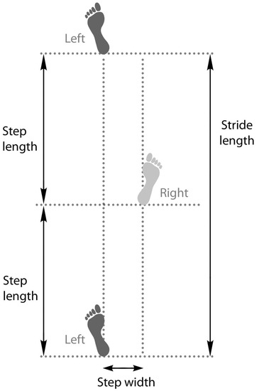 Sensory-Motor Mechanisms Increasing Falls Risk in Diabetic Peripheral ...