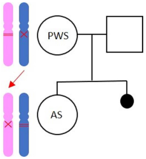 Prader–Willi Syndrome with Angelman Syndrome in the Offspring