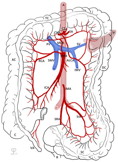 Variant Arterial Supply of the Descending Colon by the Coeliac Trunk: A ...