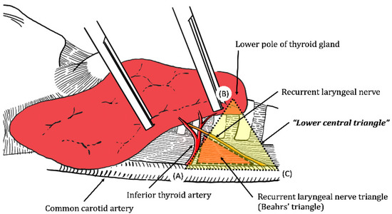Recurrent Laryngeal Nerve