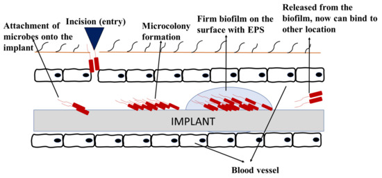 Mechanisms and Impact of Biofilms and Targeting of Biofilms Using ...