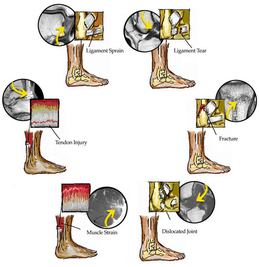 Pharmacological Treatment for Acute Traumatic Musculoskeletal Pain in ...