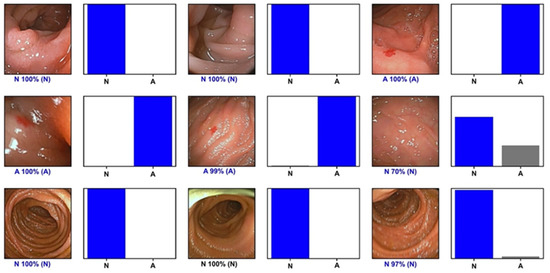 Deep Learning and Device-Assisted Enteroscopy: Automatic Detection of ...