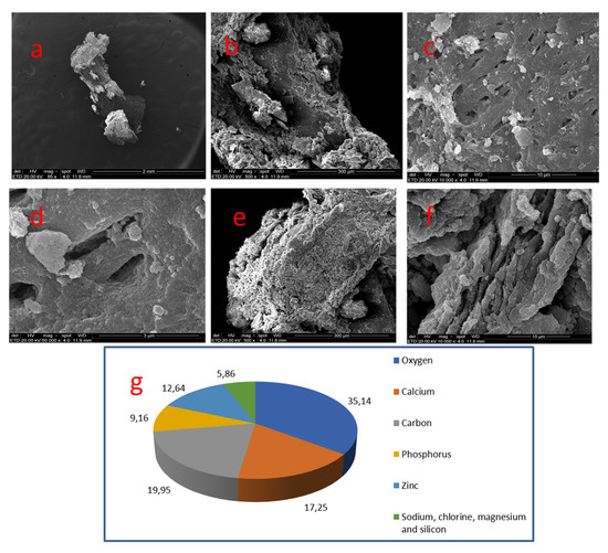 Medicina | Free Full-Text | The Pulp Stones: Morphological Analysis in ...