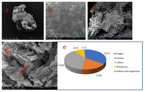 Medicina | Free Full-Text | The Pulp Stones: Morphological Analysis in ...