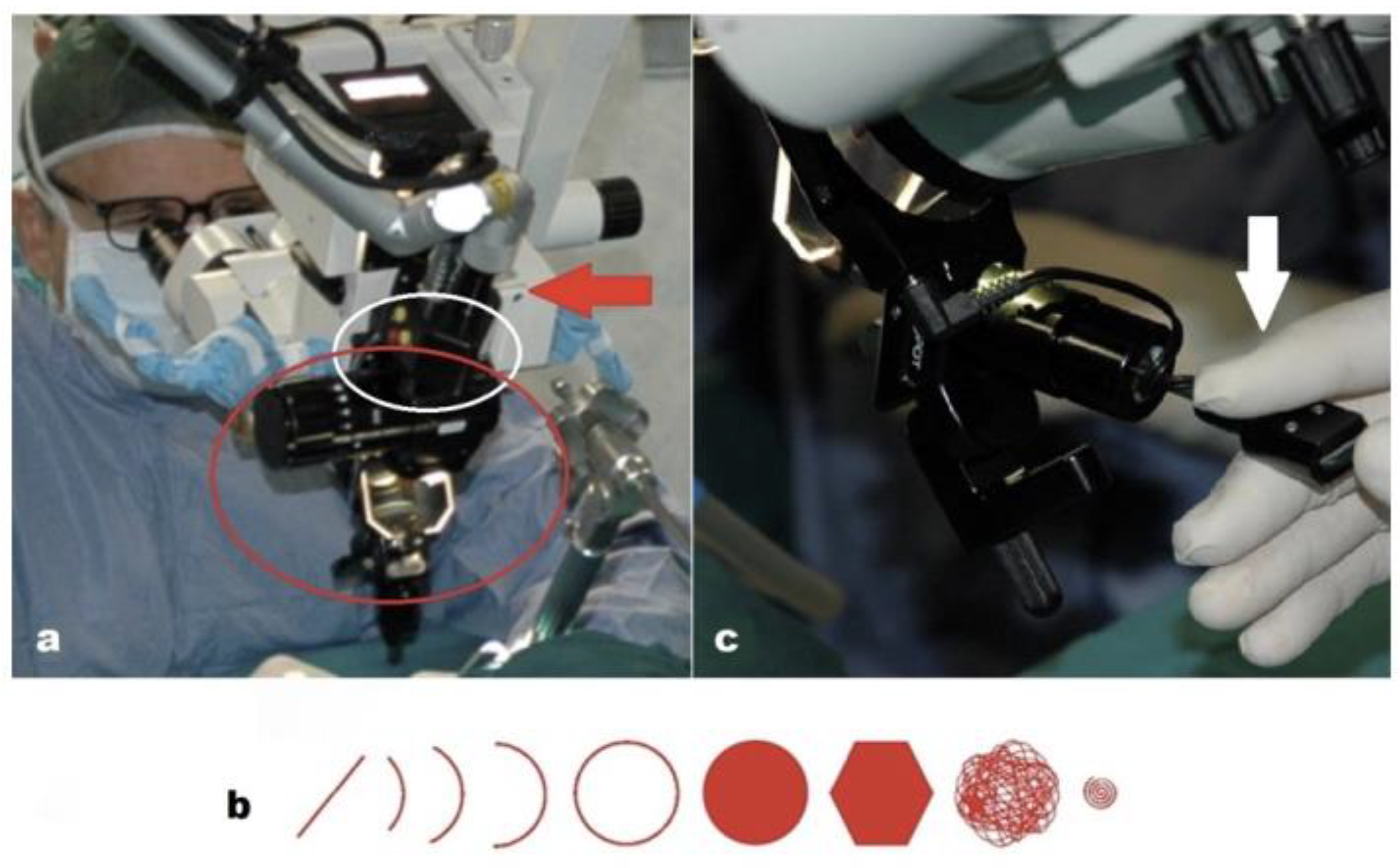 Medicina | Free Full-Text | Scanning Super/Ultrapulsed CO2 Laser ...