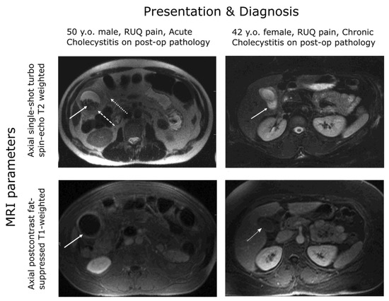 The Need for Standardizing Diagnosis, Treatment and Clinical Care of ...