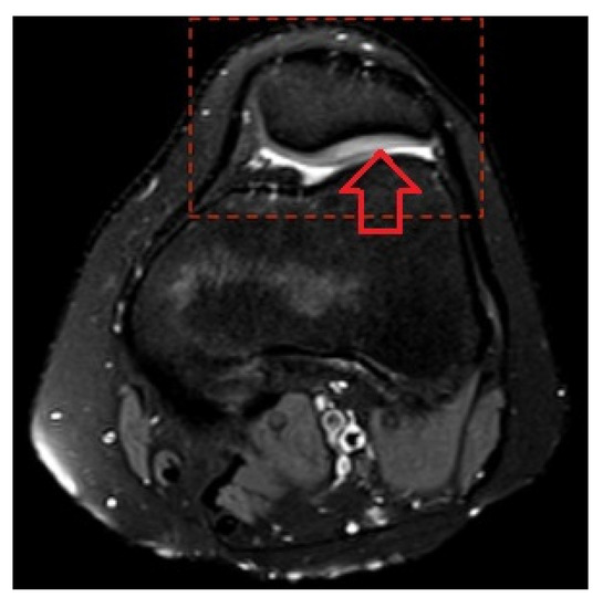 Medicina | Free Full-Text | The Magnetic Resonance Imaging Pattern of ...