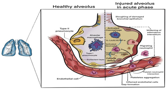 Medicina | Free Full-Text | What Is Different in Acute Hematologic ...