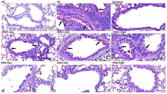 Therapeutic Efficacy of Weissella cibaria CMU and CMS1 on Allergic ...
