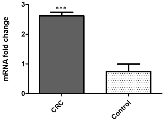 Rs10204525 Polymorphism of the Programmed Death (PD-1) Gene Is ...