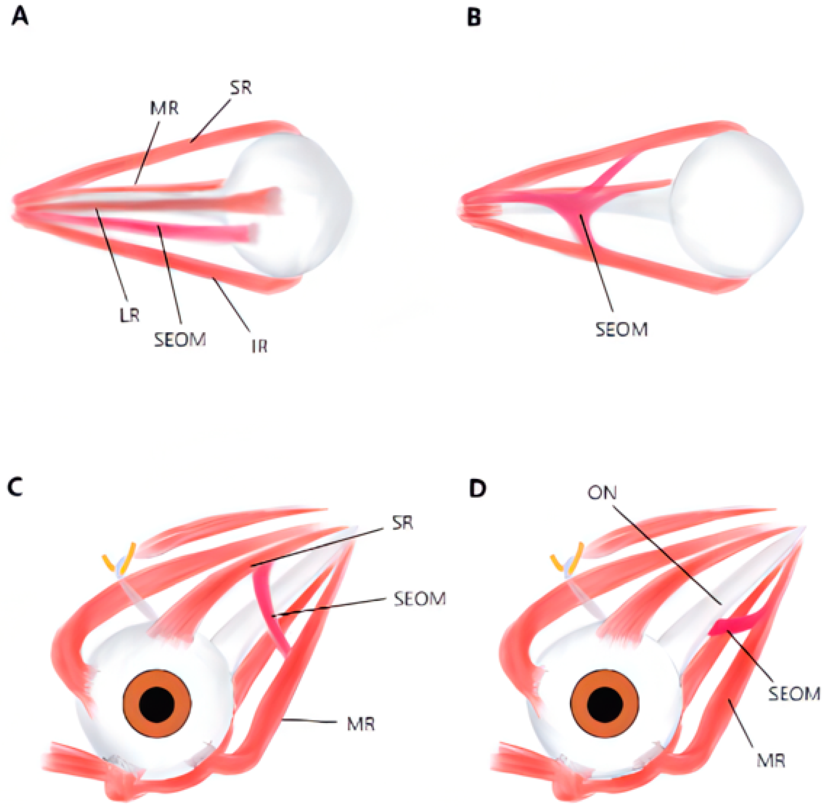 Oculomotor Muscles