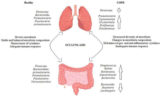 Gut–Lung Microbiota Interaction in COPD Patients: A Literature Review