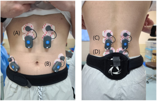 Changes in Trunk Muscle Activity during Unilateral Weight Bearing and ...