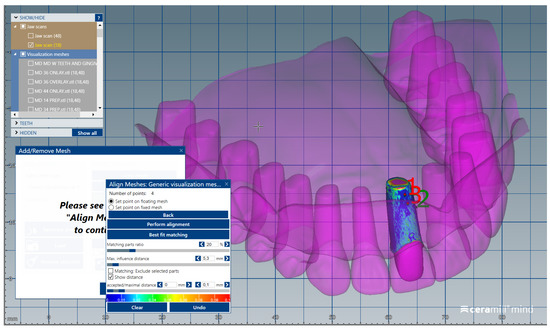 Medicina | Free Full-Text | Modular Digital and 3D-Printed Dental ...