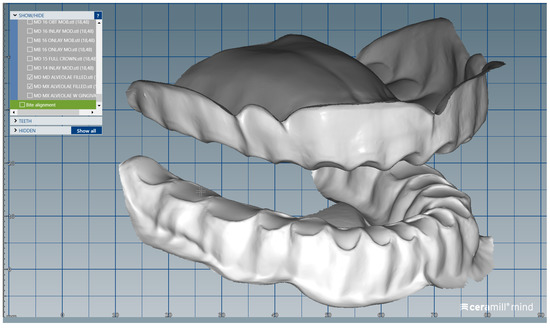 Medicina | Free Full-Text | Modular Digital and 3D-Printed Dental ...